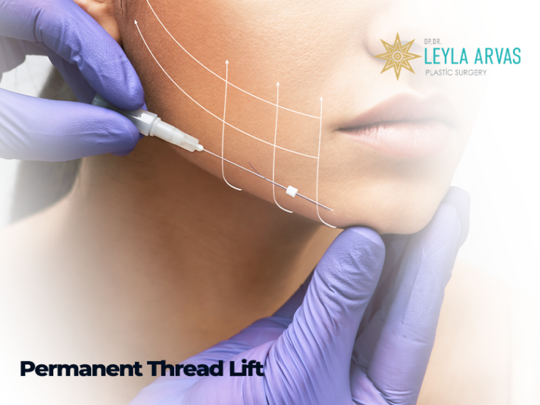 Permanent Thread Lift - Non-Surgical Facelift - ISTANBUL